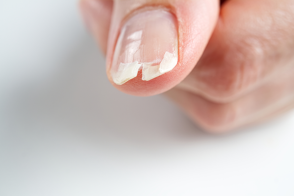 How to Fix a Broken Acrylic Nail at Home | NZ Beauty School